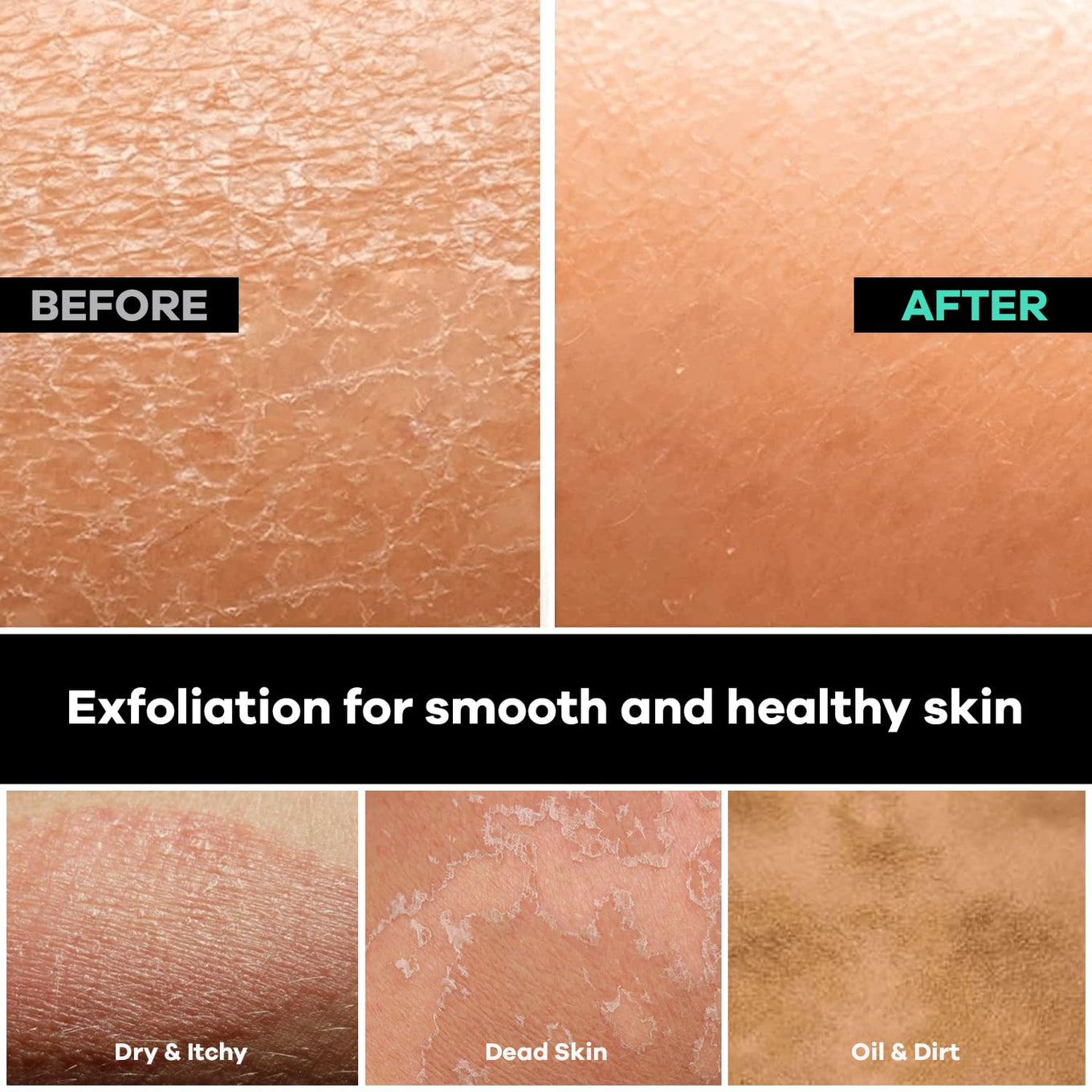 Dermasuri Deep Exfoliating Scrub for Back |Dermasuri.com